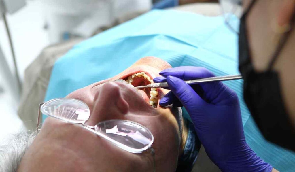 Know the Causes for Tooth Discoloration